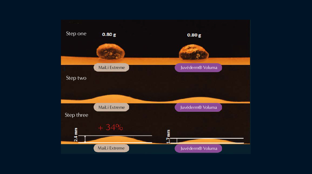 Benefits of MaiLi HA Fillers | Discover The Benefits Today - MaiLi